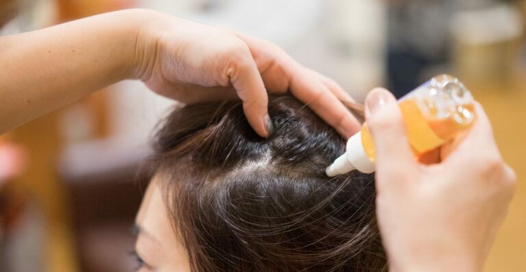 11 Hair Tonic Terbaik: Atasi Rontok, Rambut pun Sehat dan Kuat!