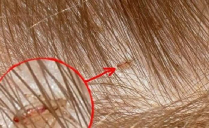 8 Cara Menghilangkan Kutu Kucing: Mati Hingga Telurnya