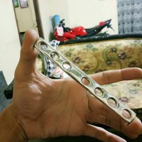 Jual Pen platina patah tulang paha tulang kering - Kota Bekasi ...