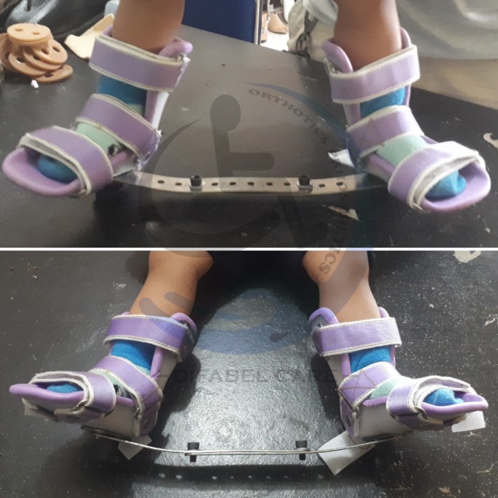 Jual Sepatu AFO CTEV / Dennis Broune ( Kaki Pengkor ) - Jakarta Timur ...