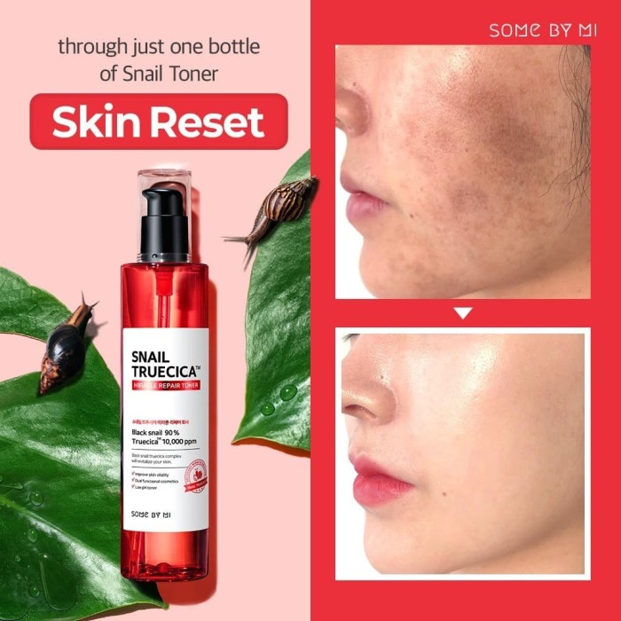 Jual SOMEBYMI Snail True Cica Miracle Repair Toner 135ml - Jakarta ...