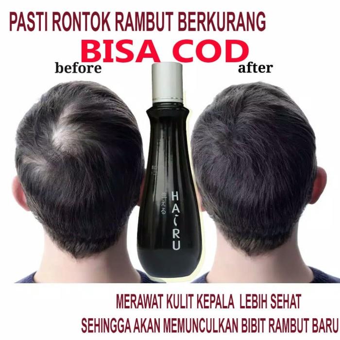 Jual Penumbuh Rambut - Kota Tangerang - beauty-glowing-shop | Tokopedia