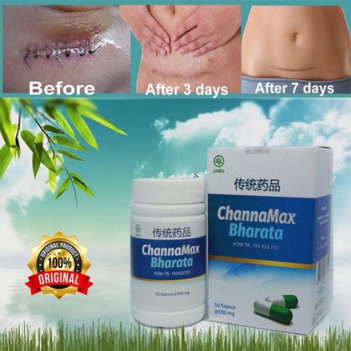 Jual Obat Cina Pengering Luka Pasca Operasi Caesar & Pengering Luka ...